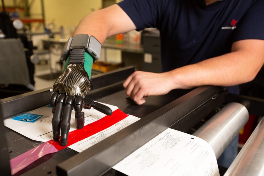 Amputation Levels | Arm Dynamics